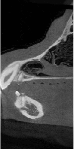 FIDEX Multi-Modality Veterinary CR/CT/Fluoroscopy Scanner from Animage
