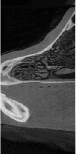 FIDEX Multi-Modality Veterinary CR/CT/Fluoroscopy Scanner from Animage