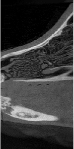 FIDEX Multi-Modality Veterinary CR/CT/Fluoroscopy Scanner from Animage
